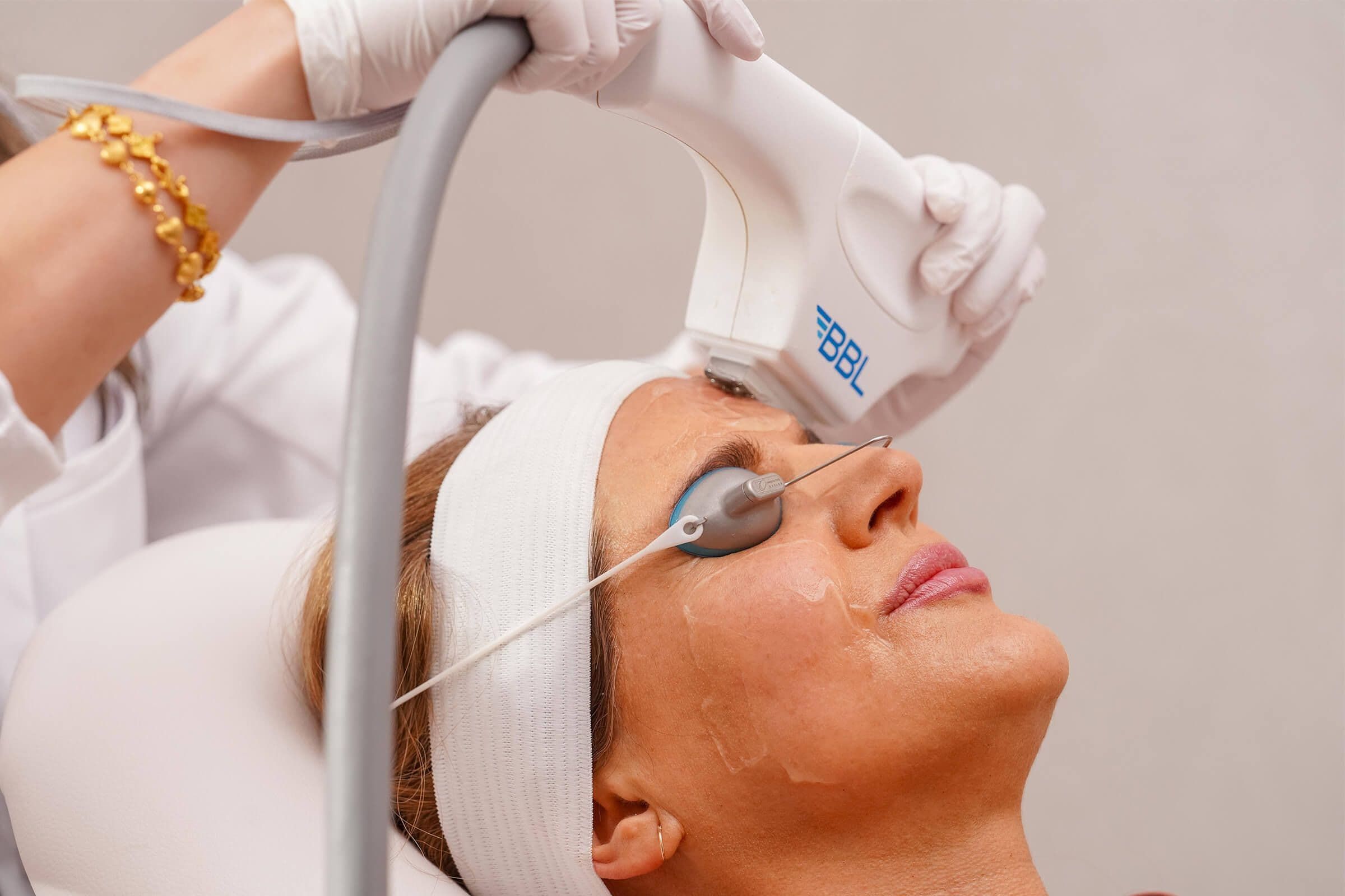 Radiance Laser Packages at Revive Med Spa