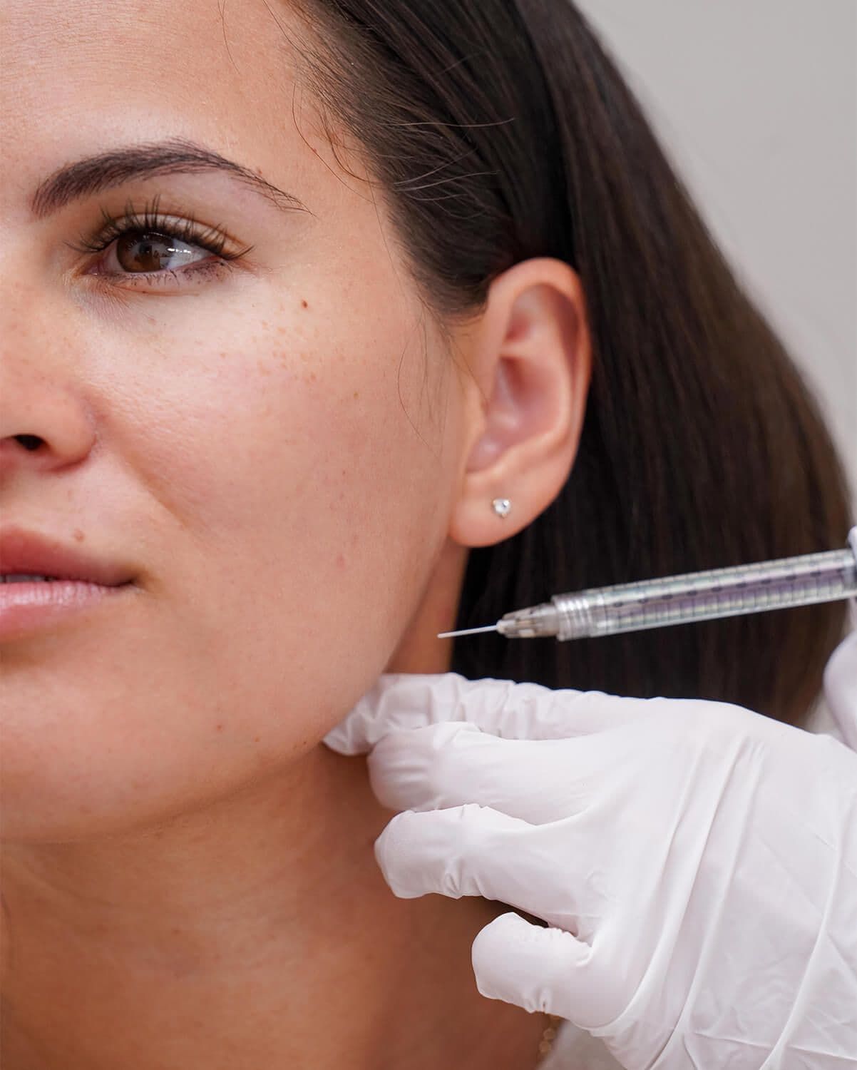 RHA Filler Treatments | Revive Med Spa